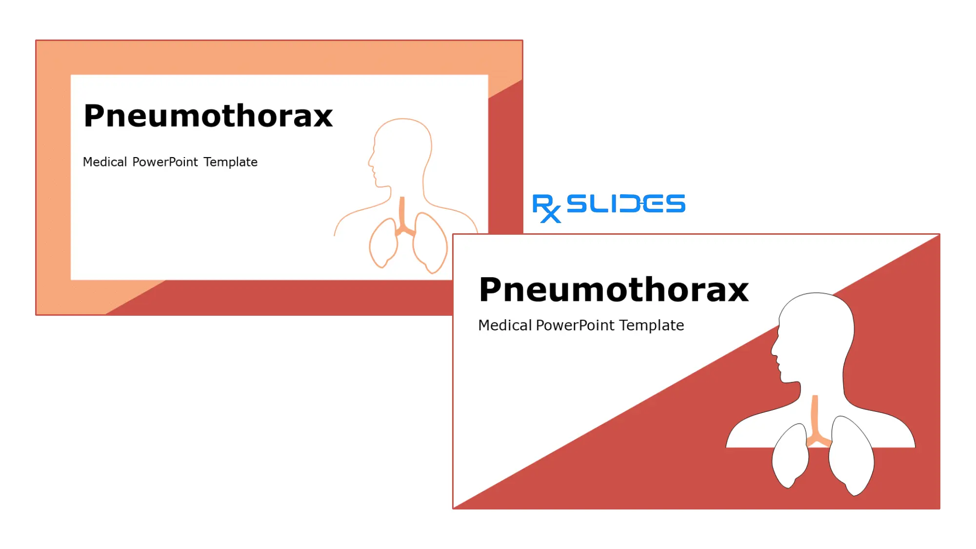 Download Pneumothorax PowerPoint Template|RxSlides